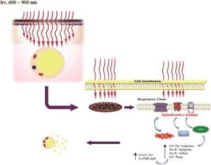 Red Light Therapy for Cellulite: Does it Work? (Before & After)