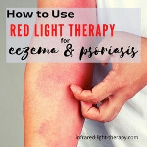 How to Use Red Light Therapy for Eczema & Psoriasis (at Home)