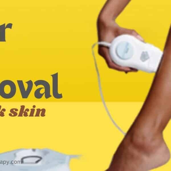 At Home Laser Hair Removal for the Face: The 3 Best Devices