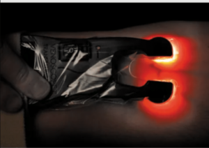 The 4 Best Infrared Vein Finders (for Nurses and Care Takers)