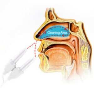 The 3 Best Nasal Red Light Therapy Devices (for Sinuses)