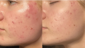 The Ultimate Guide to LED Therapy Colors (Uses & Benefits)