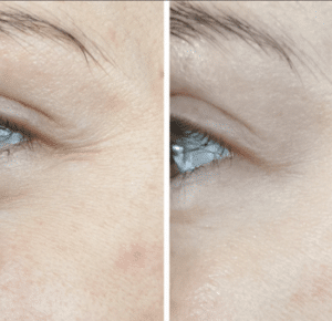 The Ultimate Guide to LED Therapy Colors (Uses & Benefits)